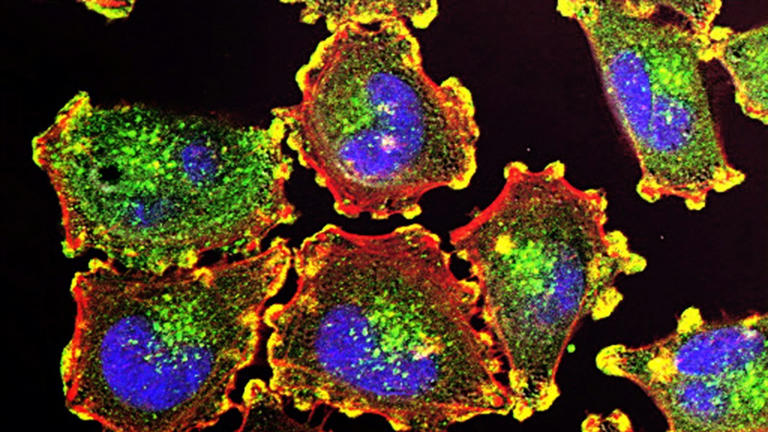 Scientists traced the energy crash of aging cells to a single fading ...