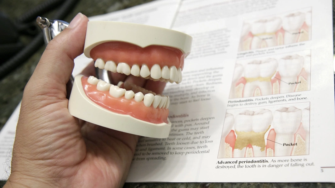 Your gums might be aging your body
