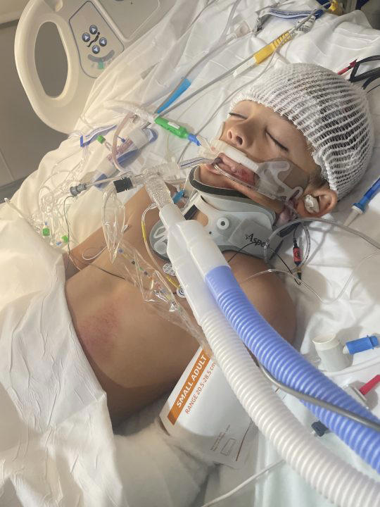 Pasco mother prays for miracle as 10-year-old son remains in coma after ...