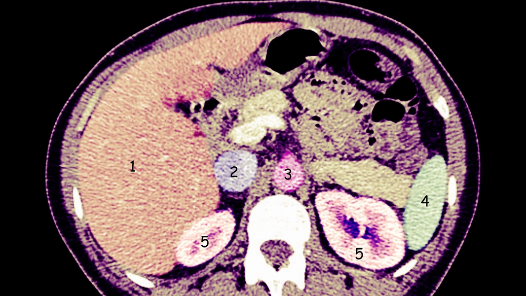 Silent signs and symptoms of fatty liver disease