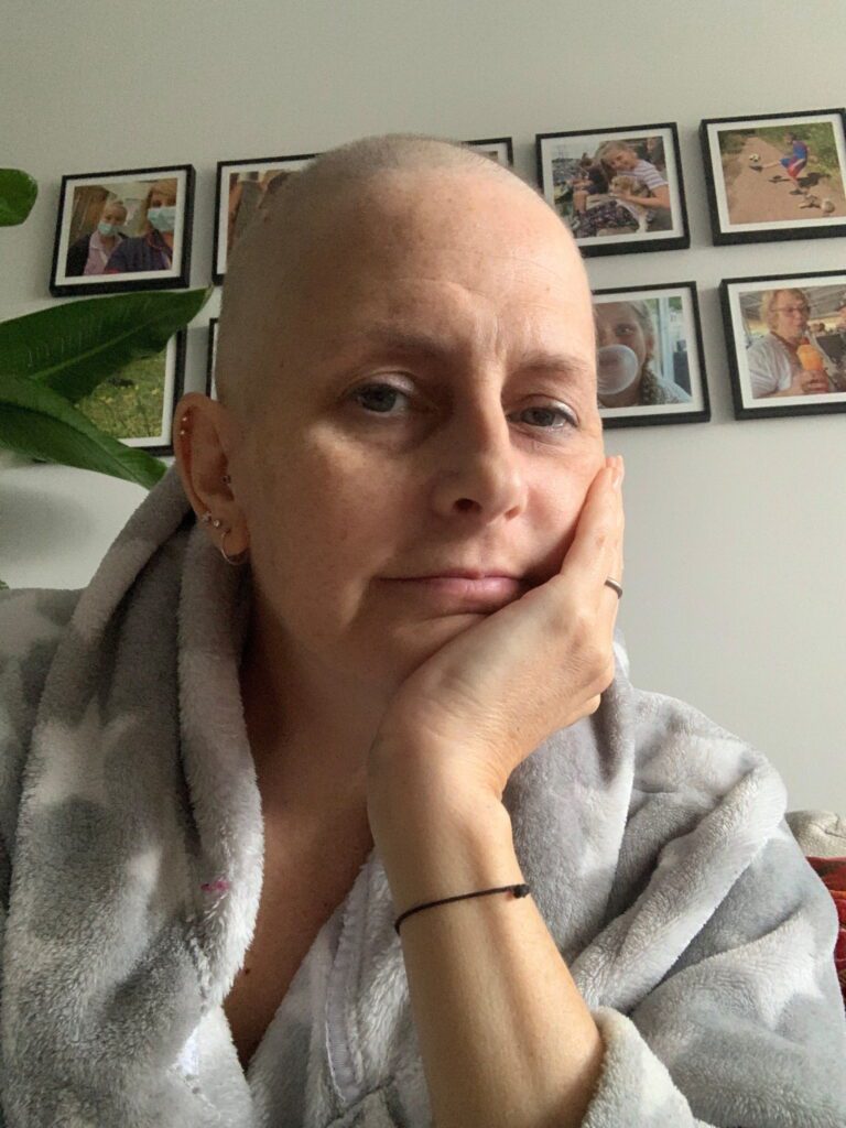 Mum’s 'harmless' football bruise injury was incurable cancer