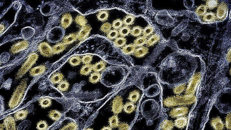 AUS records first case of deadly virus
