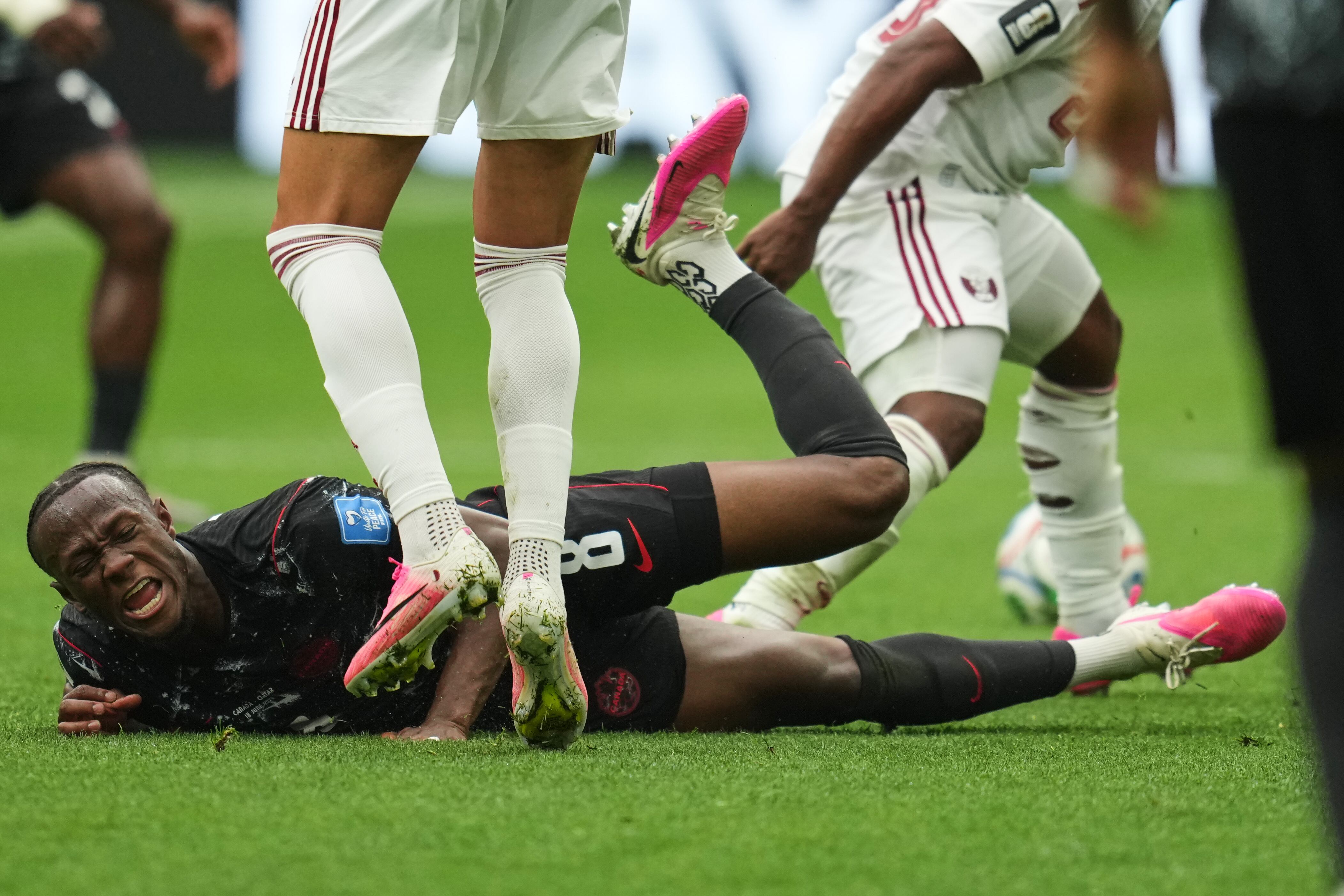 Escalofriante lesión del canadiense Koné: rotura de la tibia izquierda ...