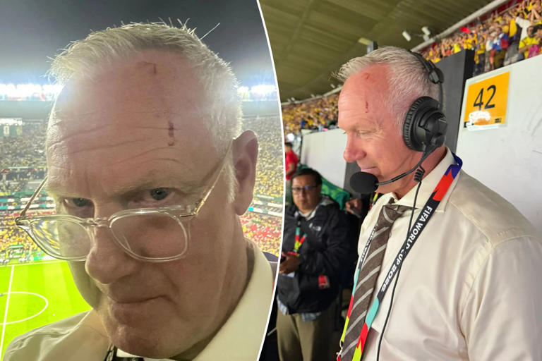 Fox Sports’ Warren Barton bloodied after being hit by 'sharp' object in ...