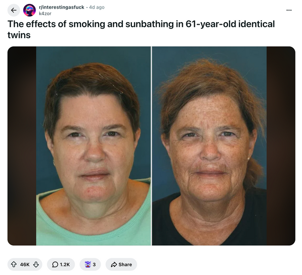 Do photos of identical twins show effects of sun exposure, smoking ...