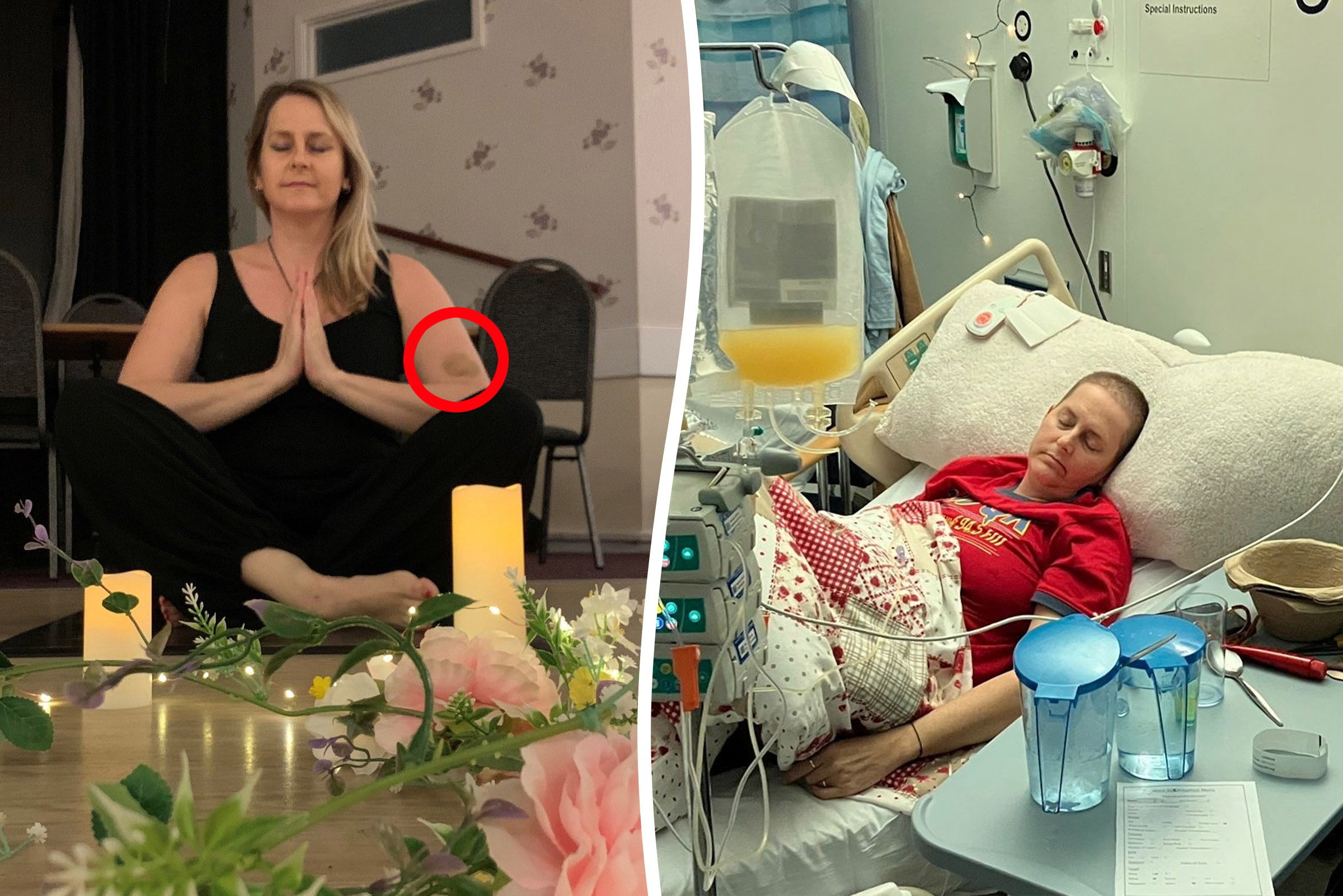 Mum’s 'harmless' football bruise injury was incurable cancer
