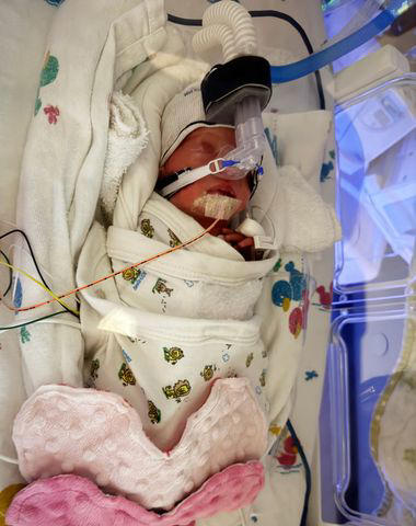 Couple conceived rare spontaneous quads. 1 pregnancy loss followed, but ...