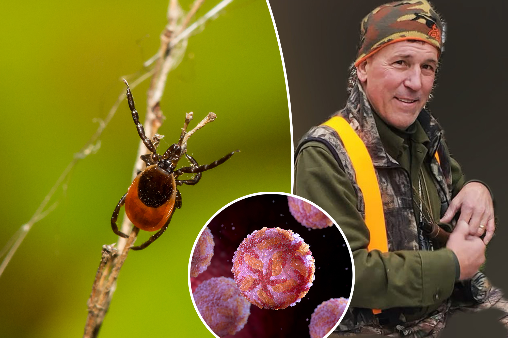 Little-known tick bite disease leaves man nonverbal — what to know ...