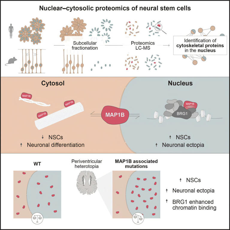 MAP1B reveals unexpected role for cytoskeletal proteins in brain ...