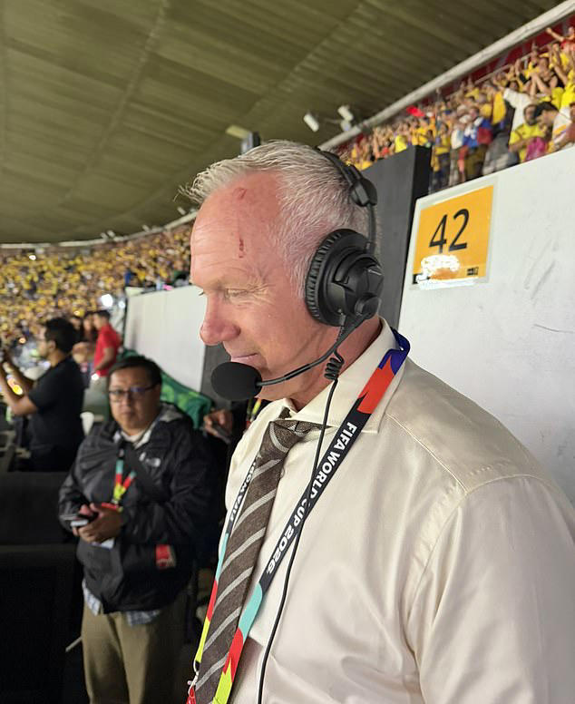 World Cup commentator left bloodied after being struck in the head by ...