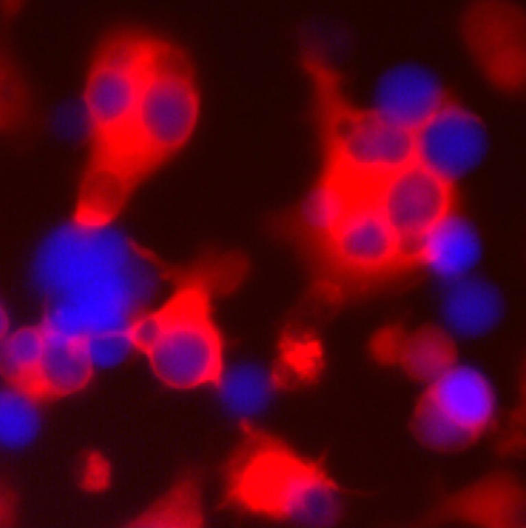 A renewable cell source for cancer immunotherapy could make off-the ...