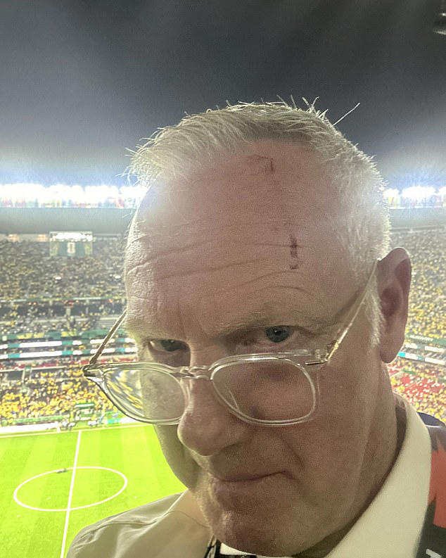 World Cup commentator left bloodied after being struck in the head by ...