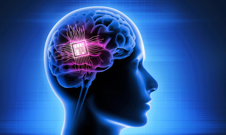 Chinese scientists create record-smashing brain implant electrode array ...