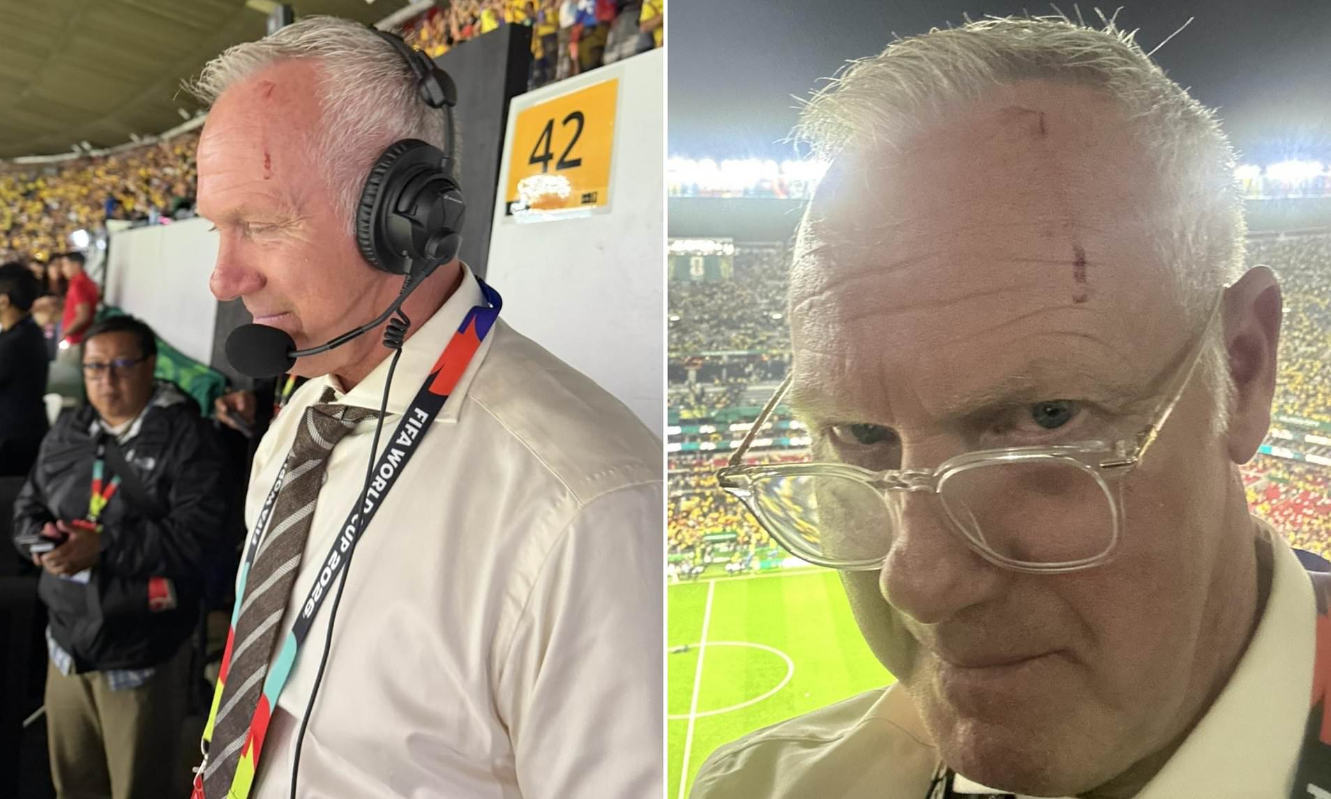 World Cup commentator left bloodied after being struck in the head by ...
