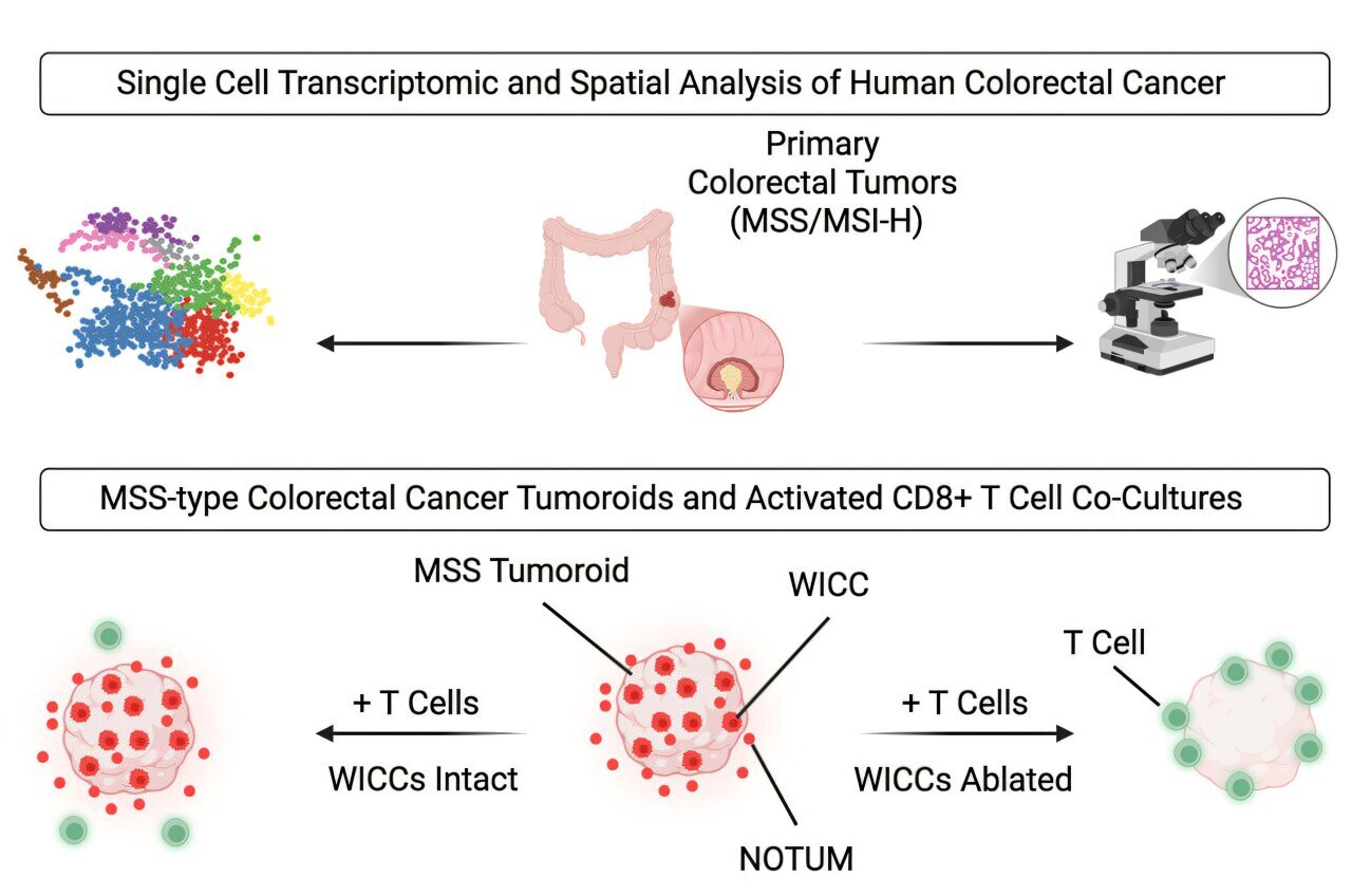 One gene deletion tears off colon cancer's invisibility cloak, boosting ...