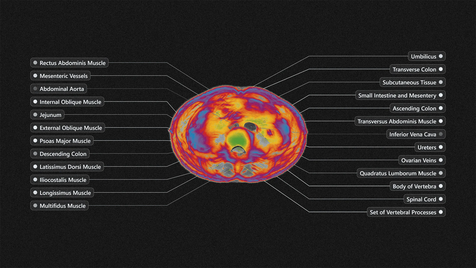 This AI company just built a new kind of full-body scanner. Using it is ...