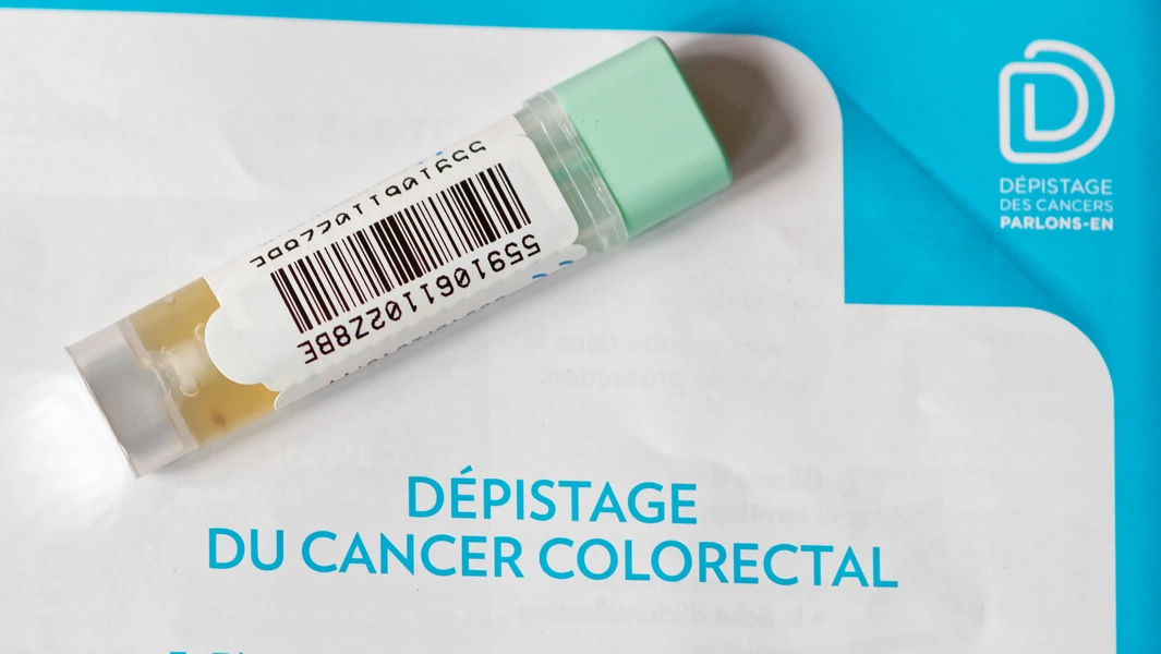 Colorectal cancer screening options and effectiveness