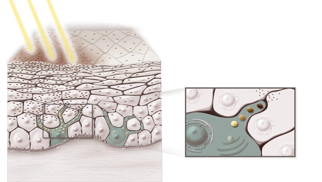Causes and solutions for accelerated skin aging