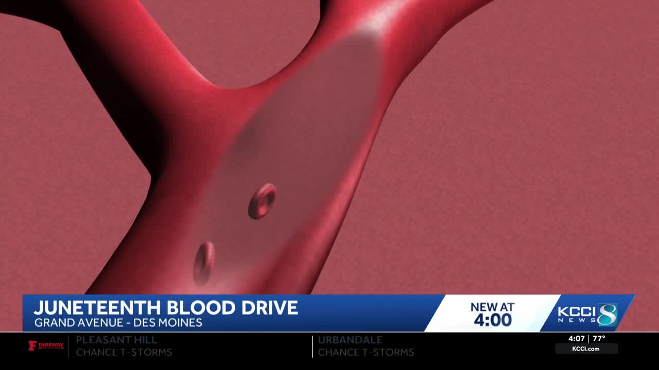 Blood donations: A way to give back on World Sickle Cell Day and Juneteenth