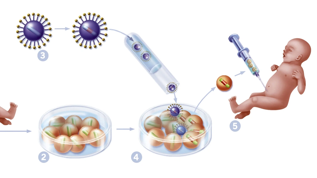 Gene therapy economics and market dynamics