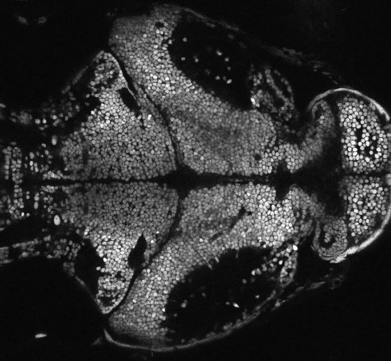 These tiny genetic fragments may be critical for telling a brain when ...