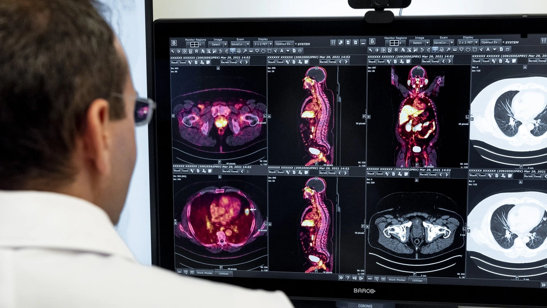 Understanding prostate cancer risks, symptoms, and treatments