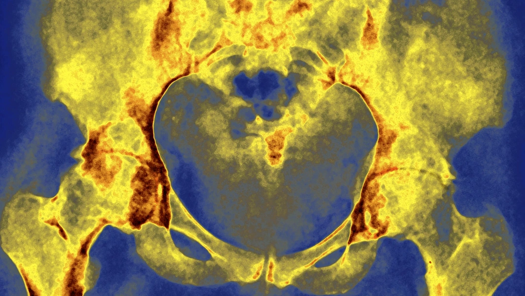 Preventing and managing hip pain effectively