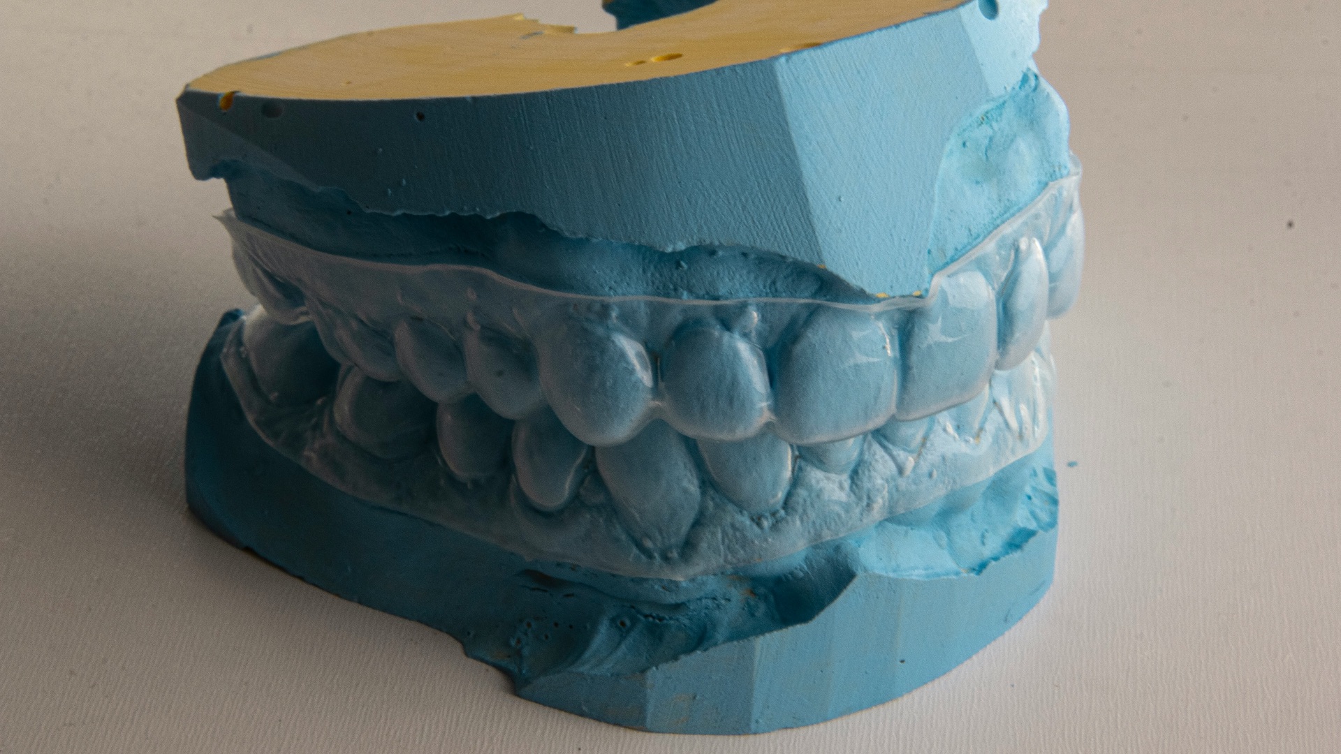 10 mistakes to never make with your retainer & 10 must-follow rules