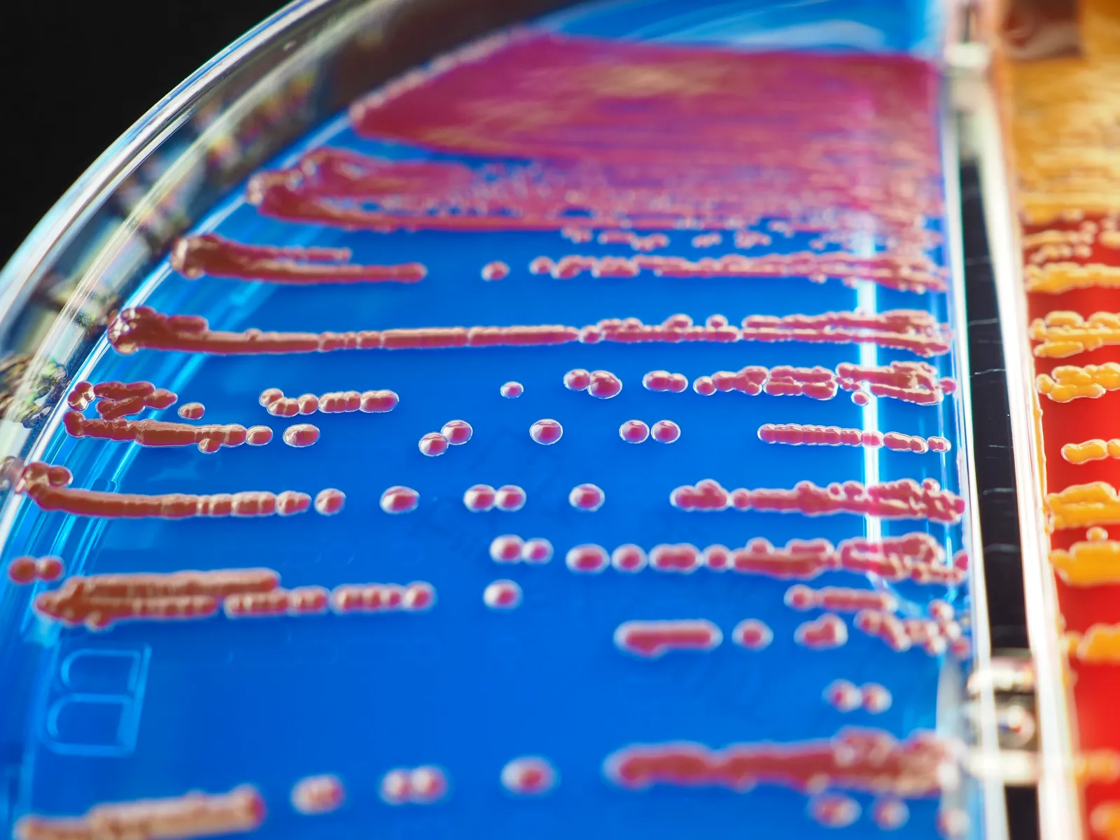 Housemates share 26% of oral microbes