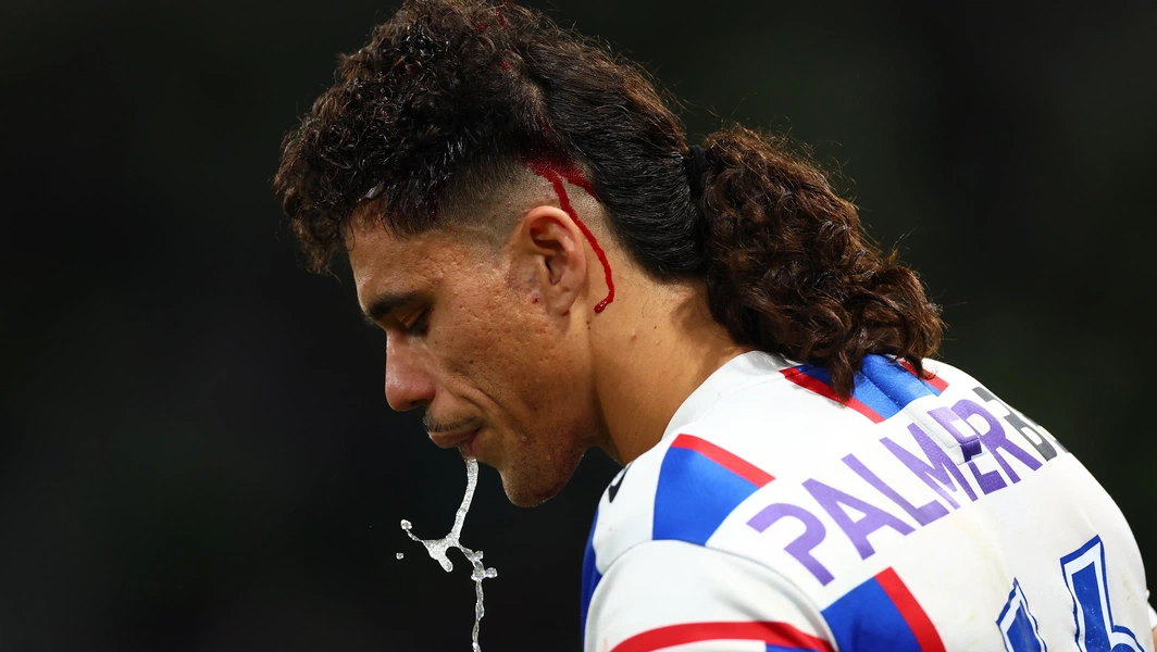 Knights suffer double surgery blow to forward pack
