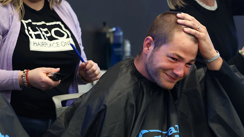 Bald positivity movement challenges hair loss stigma