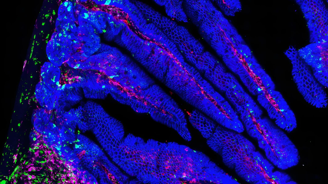 Small daily habits that shape your gut health