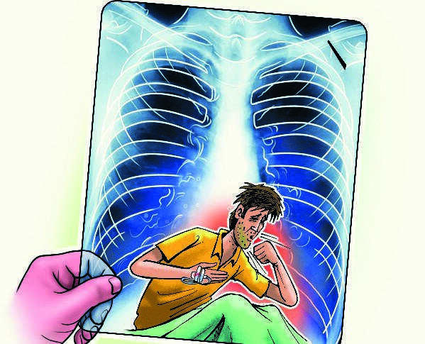 Village-level screenings intensified to identify tuberculosis at early ...