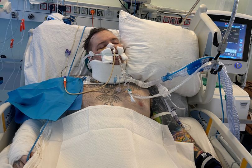 Greek holiday horror as Brit, 27, suffers injured in quad‑bike crash on ...