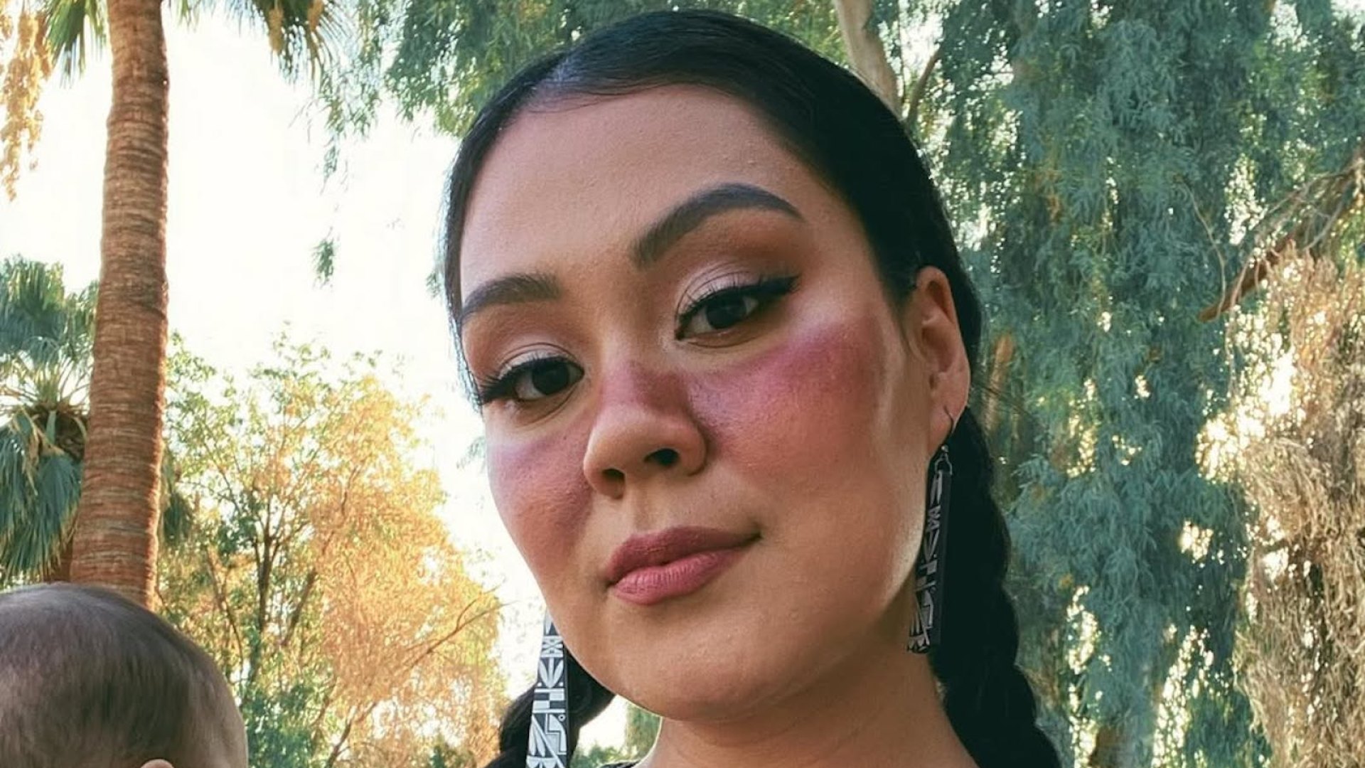 Influencer Siera Amaya had 'life-saving' surgery after ectopic pregnancy
