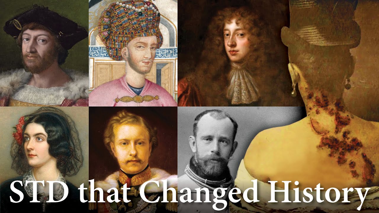 Royals, nobles & mistresses with syphilis