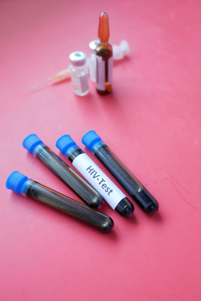 Doctor debunks 4 HIV testing myths that continue to prevent early diagnosis