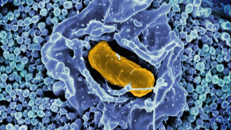 A gut bacterium is turning drug-resistant and causing chronic urinary ...