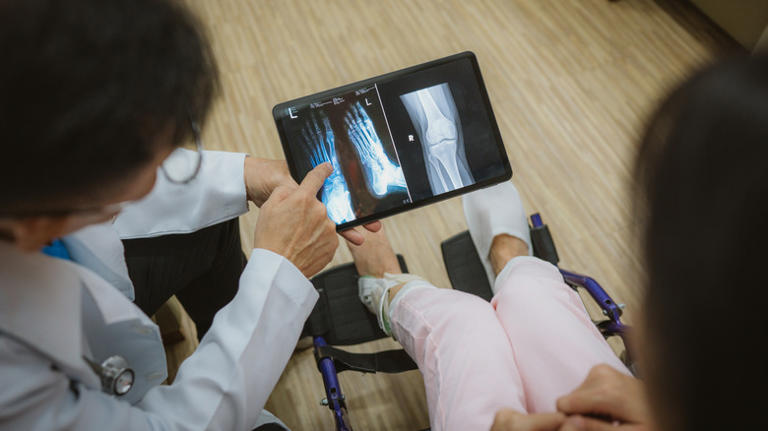 The rare 'glass bone' disease that's easily explained by science