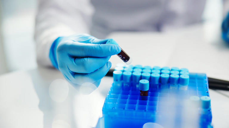 The rare 'glass bone' disease that's easily explained by science