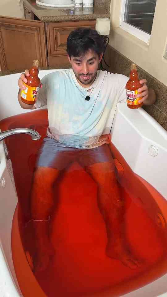 You will not believe what my friend put hot sauce on