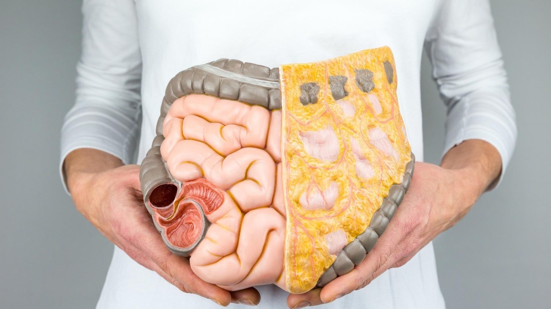 Could it be colon cancer? 5 early warning signs to know