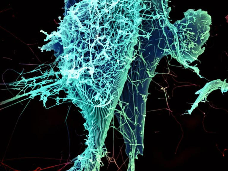 Bundibugyo Ebola outbreak exceeds 1,000 cases, with first case outside ...