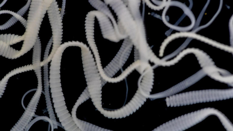 Doctors thought man had brain cancer — they found live tapeworms instead
