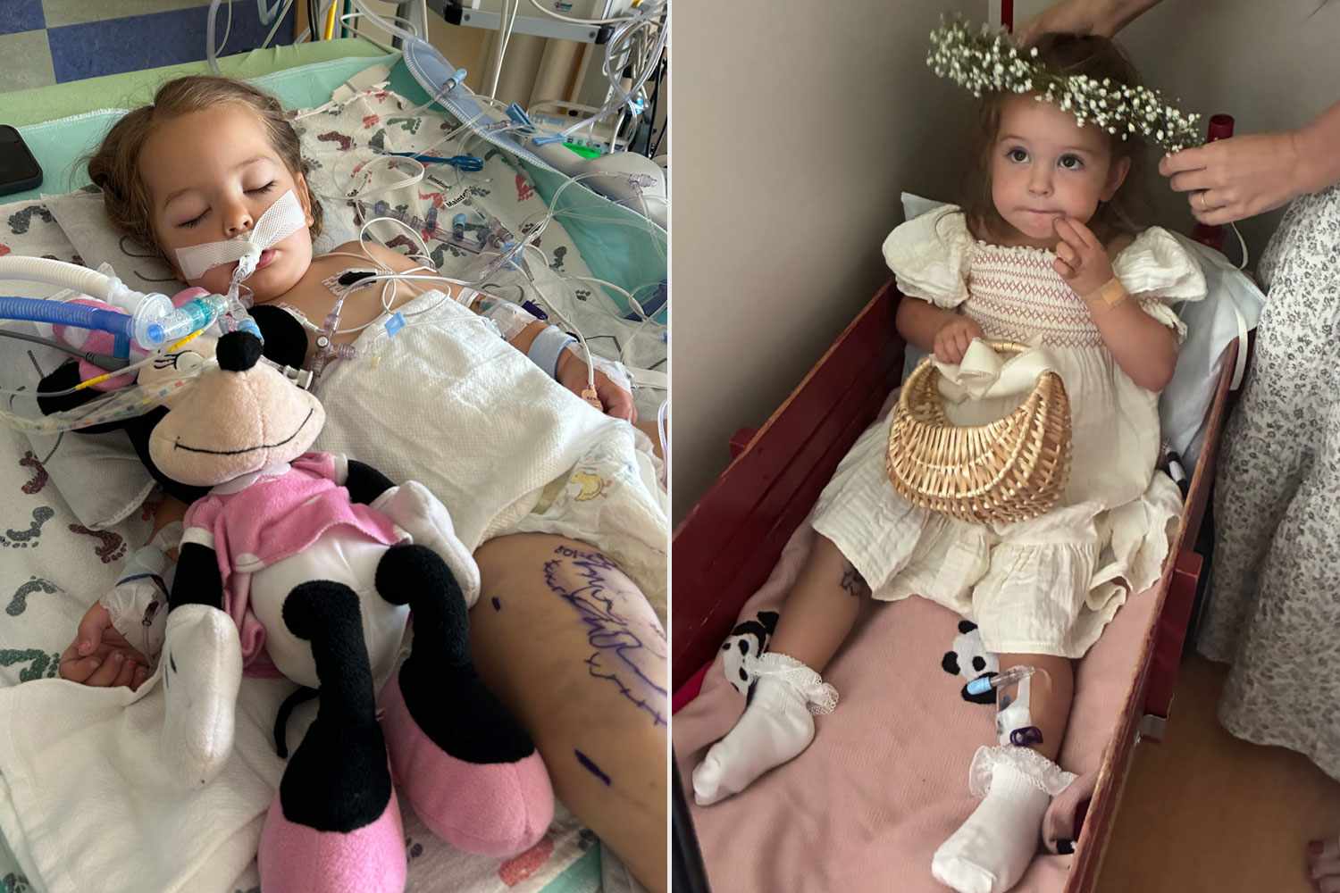 Toddler needed 30 vials of antivenom after rattlesnake bite before ...