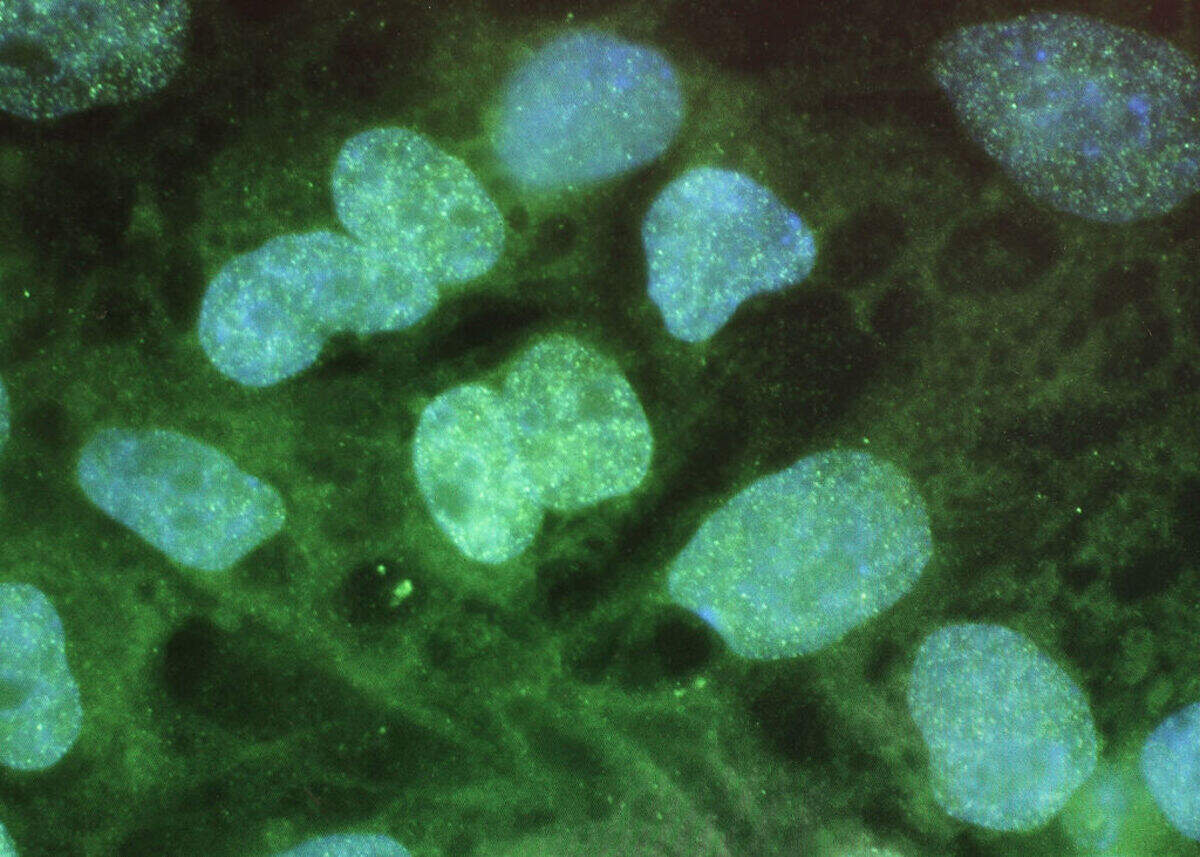 New research links semaglutide to improved lymphatic function: Why ...