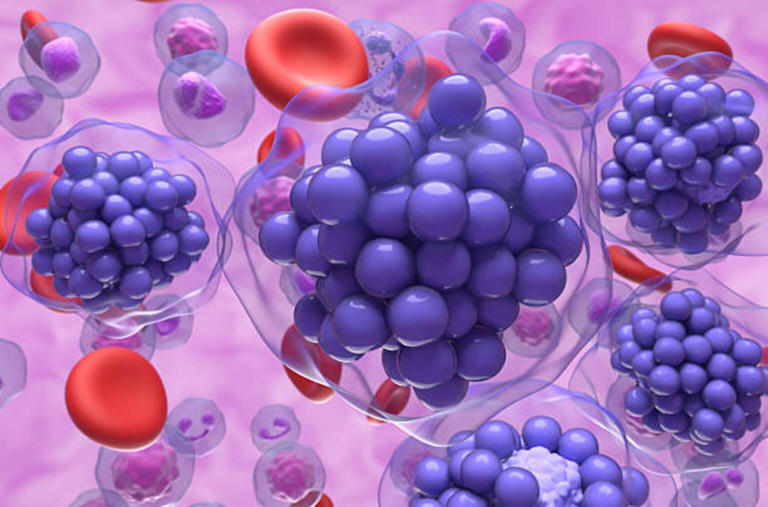 AbbVie touts phase 3 results for Epkinly in 2L large B-cell lymphoma