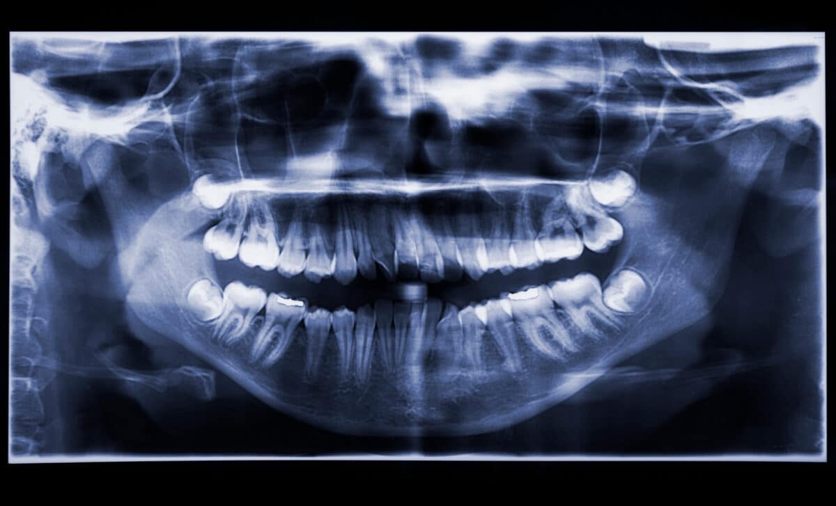Humans may soon grow a third set of teeth, and Japan has already ...