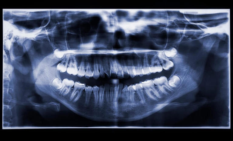 Humans may soon grow a third set of teeth, and Japan has already ...