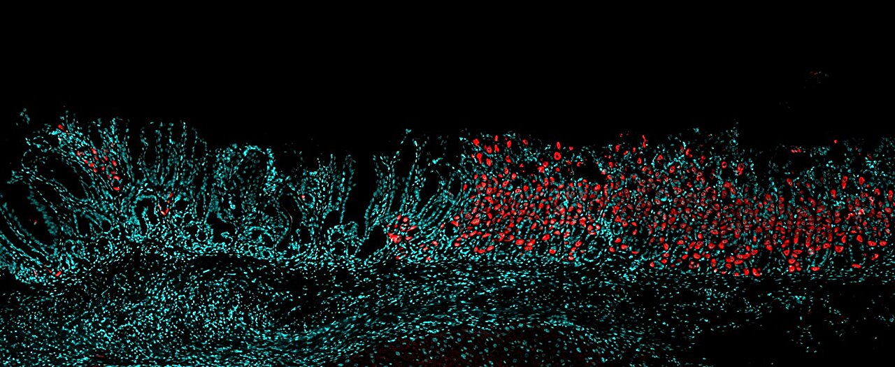 Uncovering gene-based clues to how disrupted healing in stomach cells ...